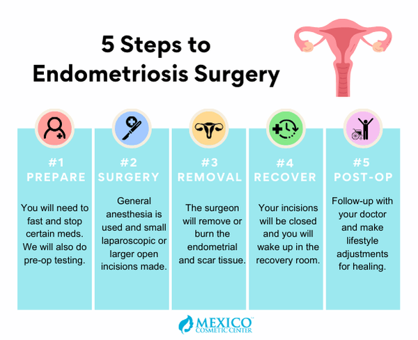 Endometriosis Surgery - Mexico Cosmetic Center